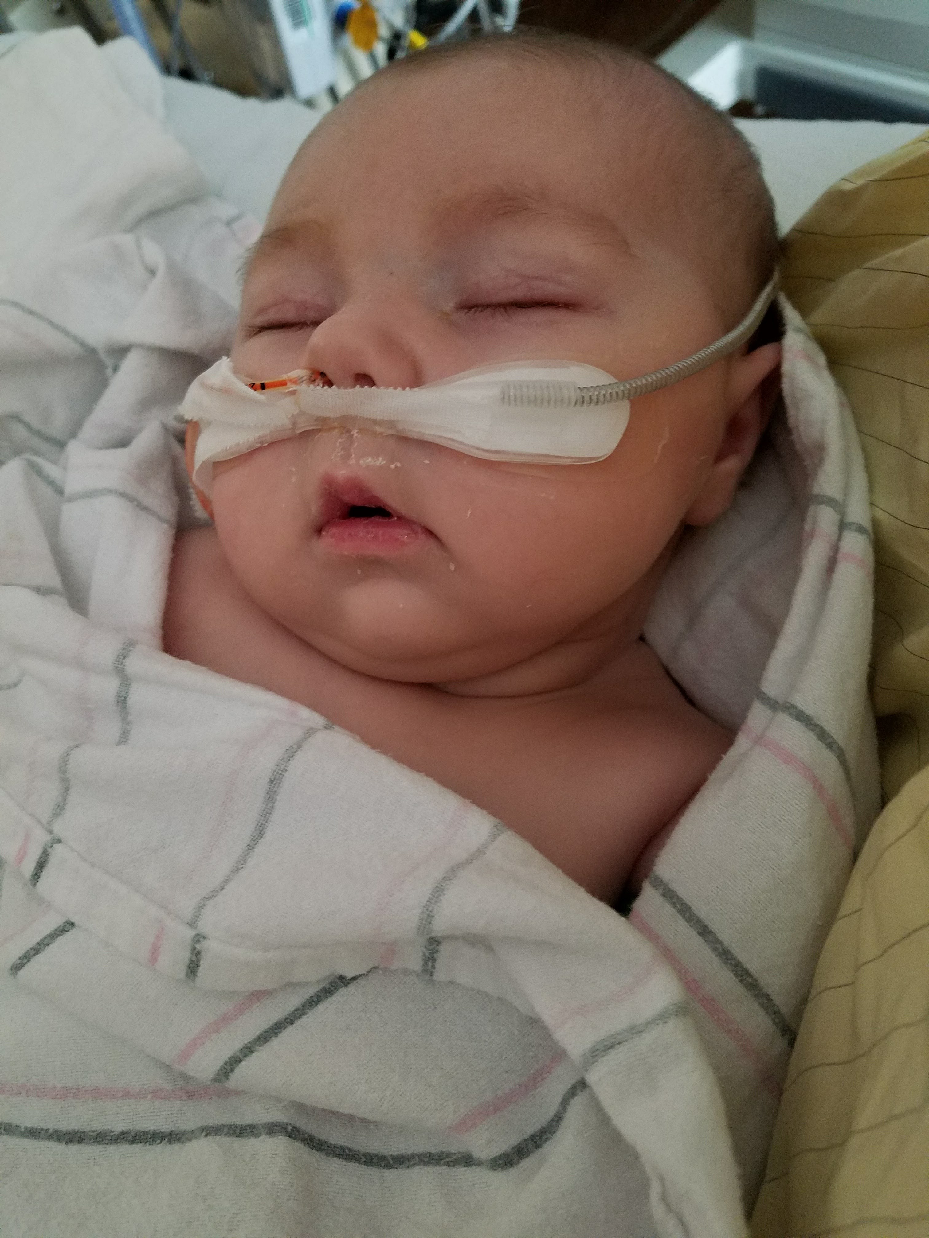 Uncover-Ostomy-Keira-2 - Uncover Ostomy